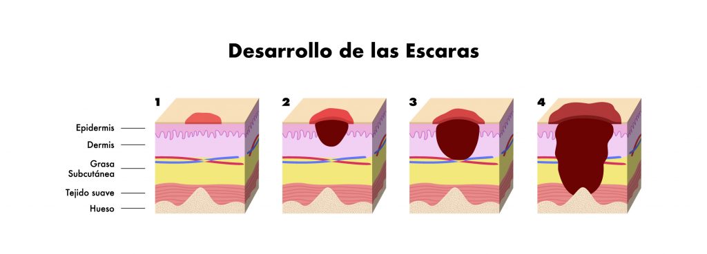 Productos antiescaras • Enclave de Salud